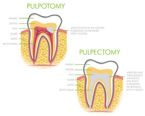 Module11 - Dental Tutors - NEBDN Dental Nurse Courses Online